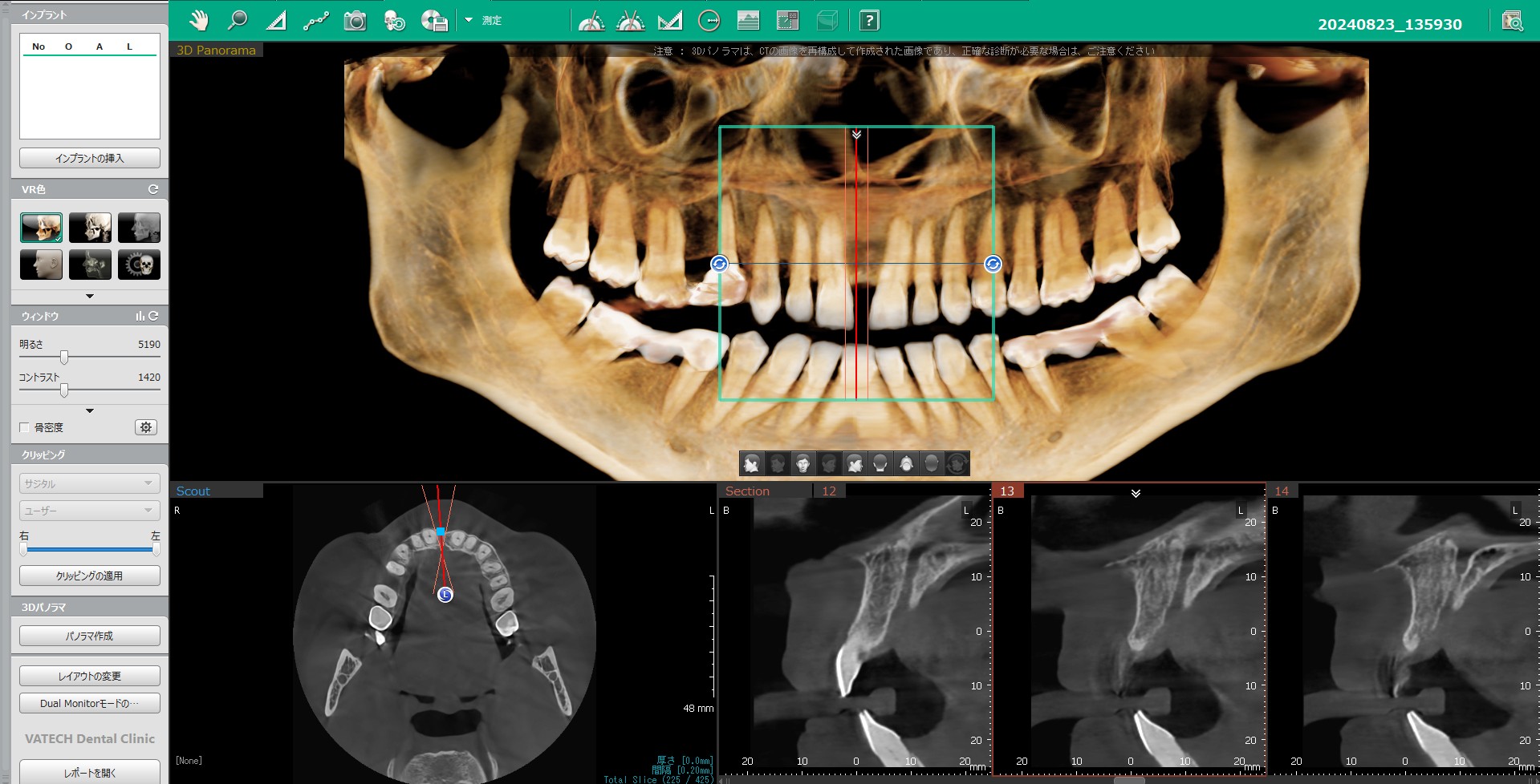 Ez3D-i | vatech japan